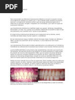 Tabla de Moyers | PDF