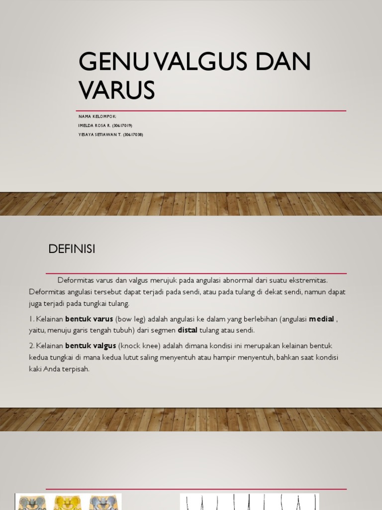 Deformitas Genu Valgus dan Varus | PDF