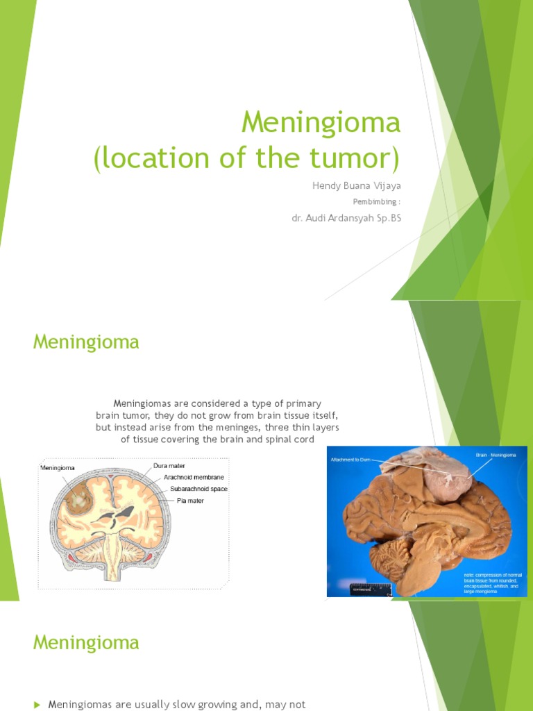 Meningioma | PDF | Headache | Spinal Cord