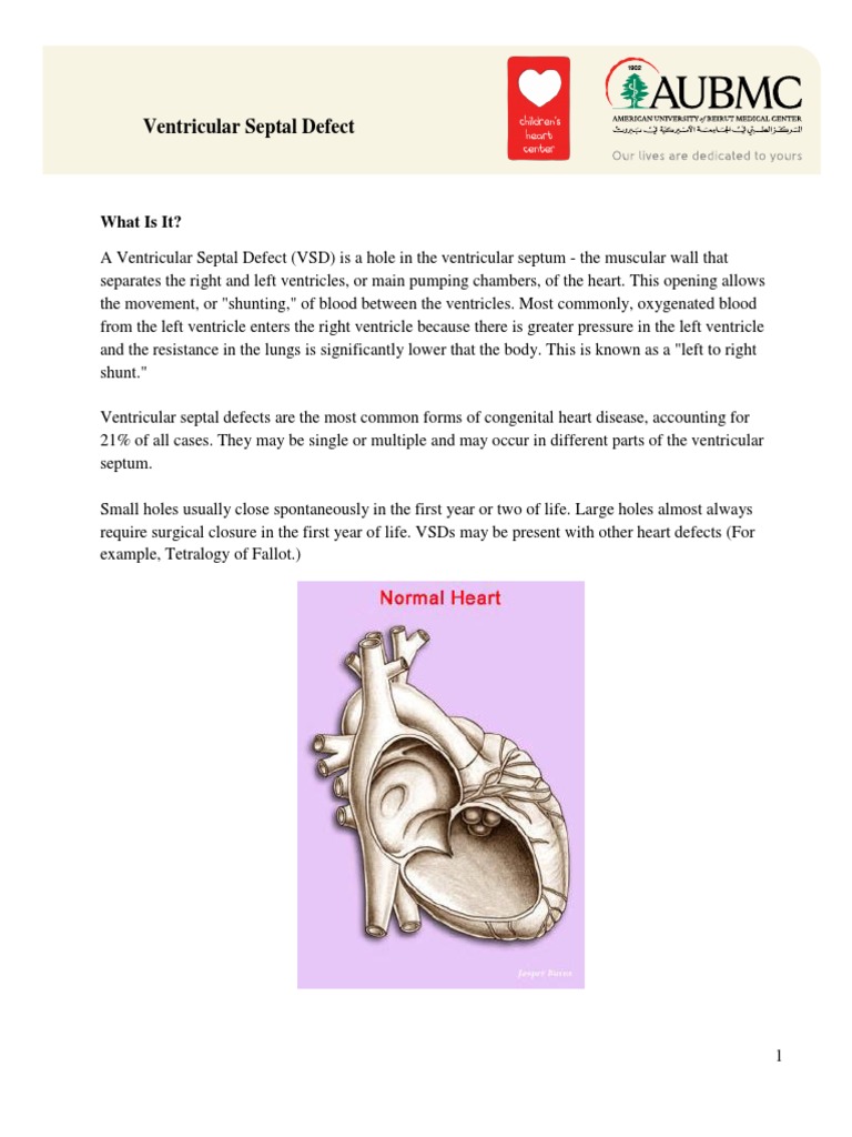 Ventricular Septal Defect | PDF | Congenital Heart Defect | Ventricle ...