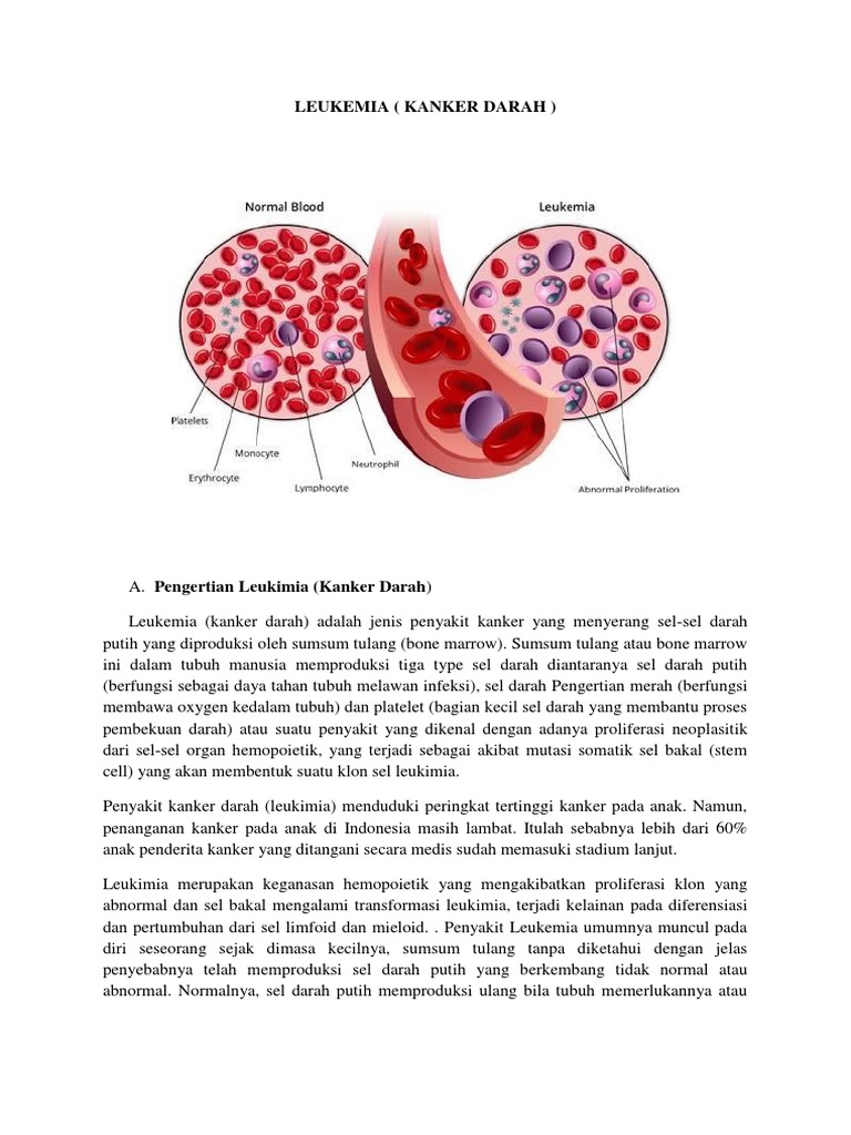 Ciri dan Penanganan Leukimia Anak | PDF | Pengembangan Diri | Kesehatan ...