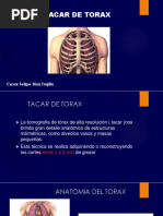 Colangiografía por Sonda T: Guía Completa | PDF | Bilis | Hígado