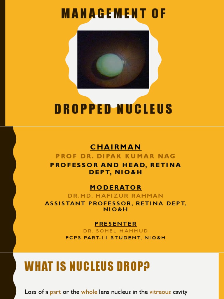 Dropped Nucleus Management | PDF | Surgery | Senses