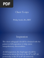 Chest X-Ray Template | PDF | Lung | Thorax