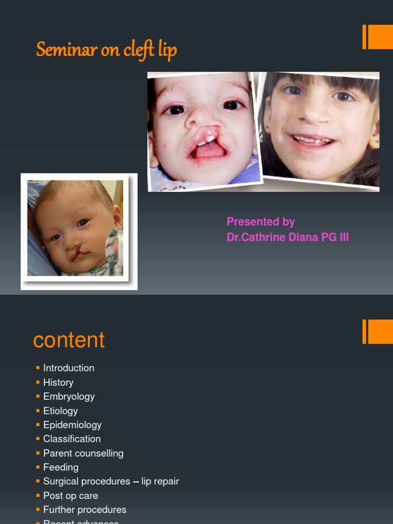 Seminar On Cleft Lip: Presented by DR - Cathrine Diana PG III | PDF ...