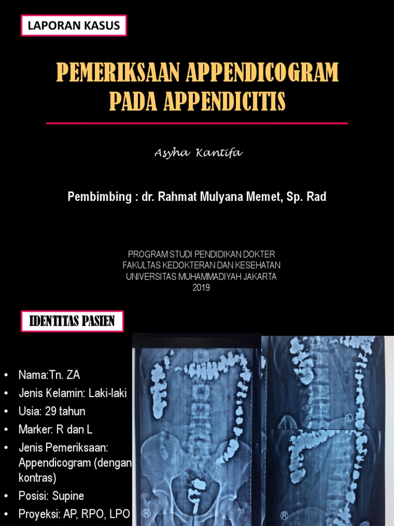Lapkas - Appendicitis | PDF