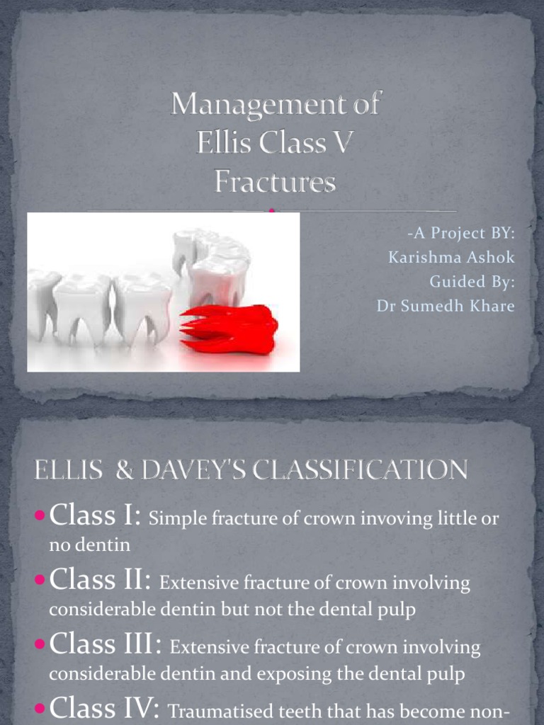 Ellis Fractures | Download Free PDF | Human Tooth | Healing