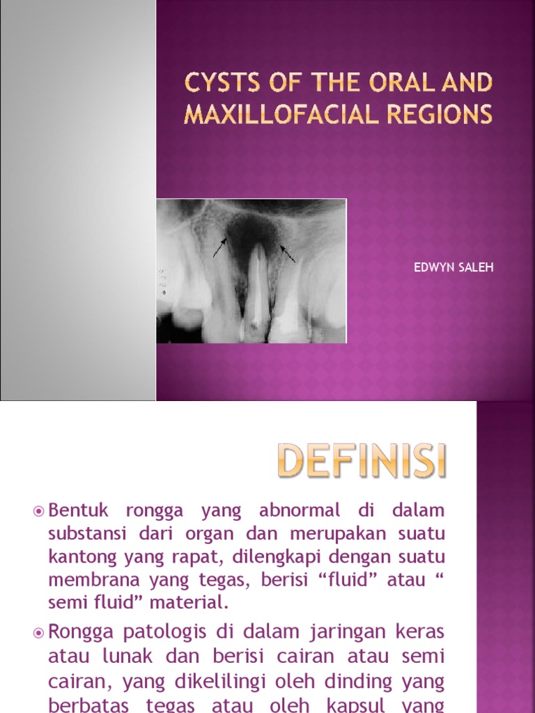 Klasifikasi Kista | PDF | Mouth | Animal Anatomy