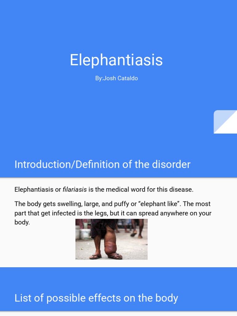 Elephantiasis | PDF | Veterinary Medicine | Public Health