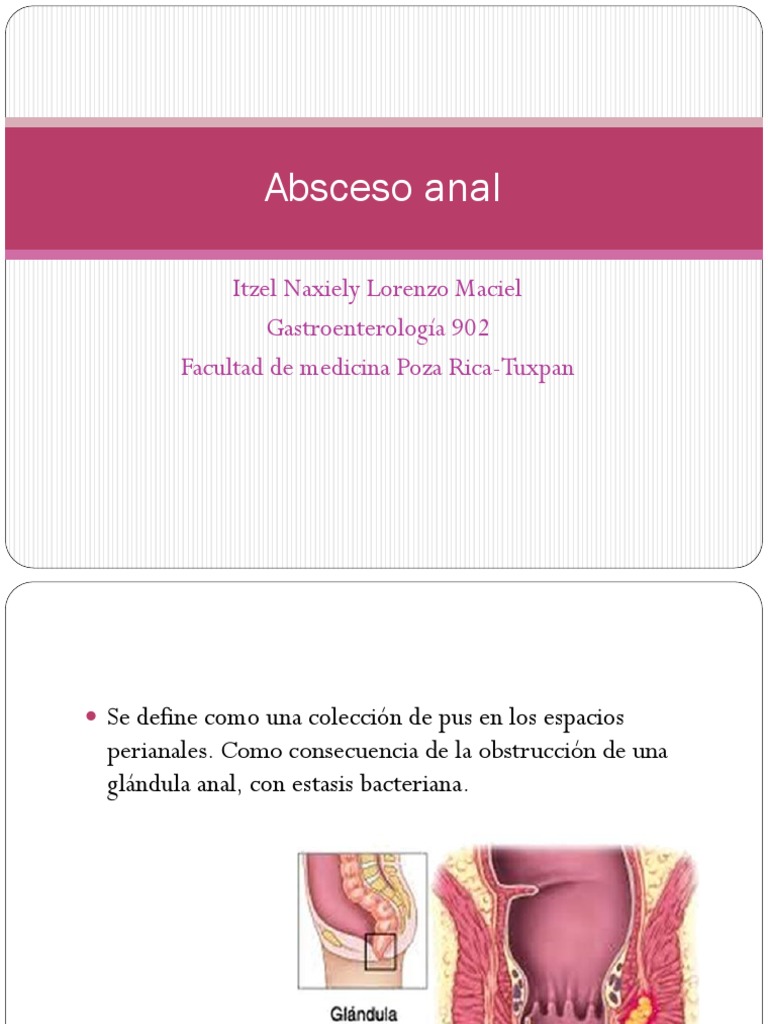 Abseso Anal | PDF | Rtt | Enfermedades y trastornos