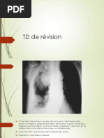 Scanner TDM Thoracique en Coupes | PDF | Aorte | Thorax