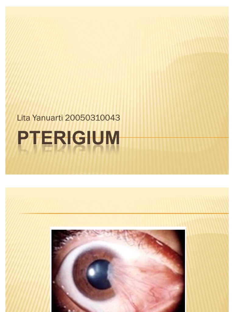 PTERIGIUM | PDF