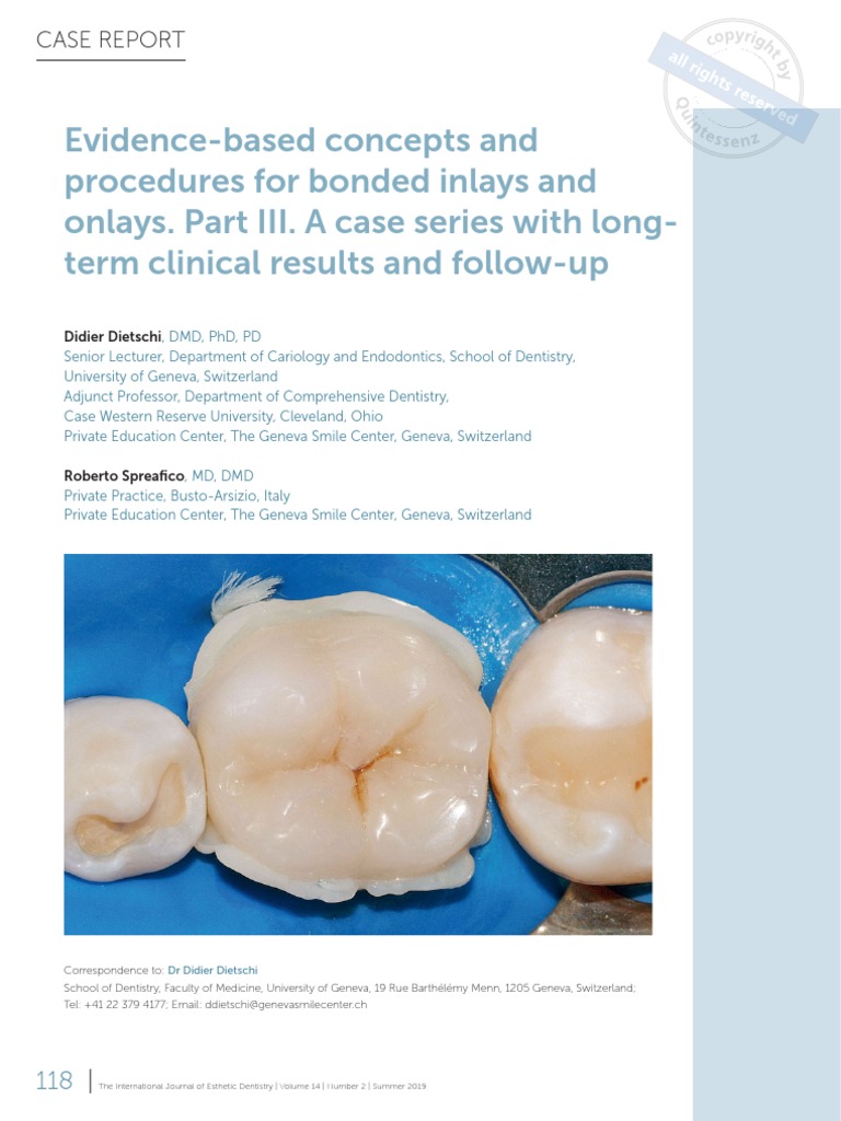 Evidence Based Concepts and Procedures For Bonded Inlays and Onlays ...