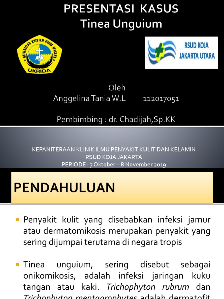 Tinea Unguium: Diagnosis dan Pengobatan | PDF | Kesehatan Holistik ...