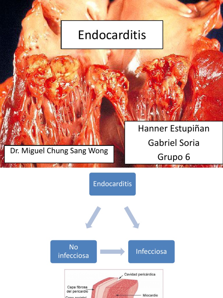 Endocarditis: Hanner Estupiñan Gabriel Soria Grupo 6 | Penicilina ...