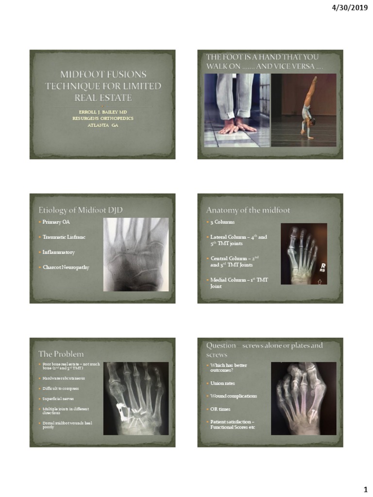 Midfoot Fusion Techniques Overview | PDF | Peripheral Neuropathy ...