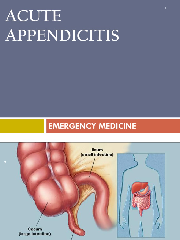Appendicitis PPT 1 | PDF | Digestive Diseases | Diseases And Disorders