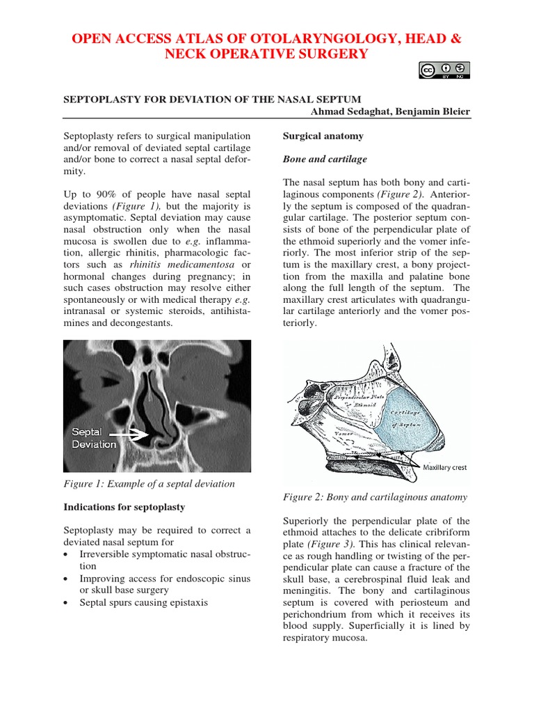 Septoplasty | PDF | Human Nose | Human Head And Neck