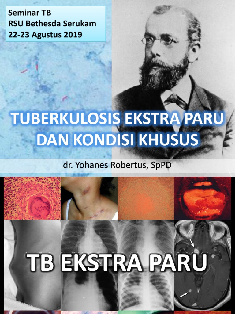 TB Ekstra Paru | PDF