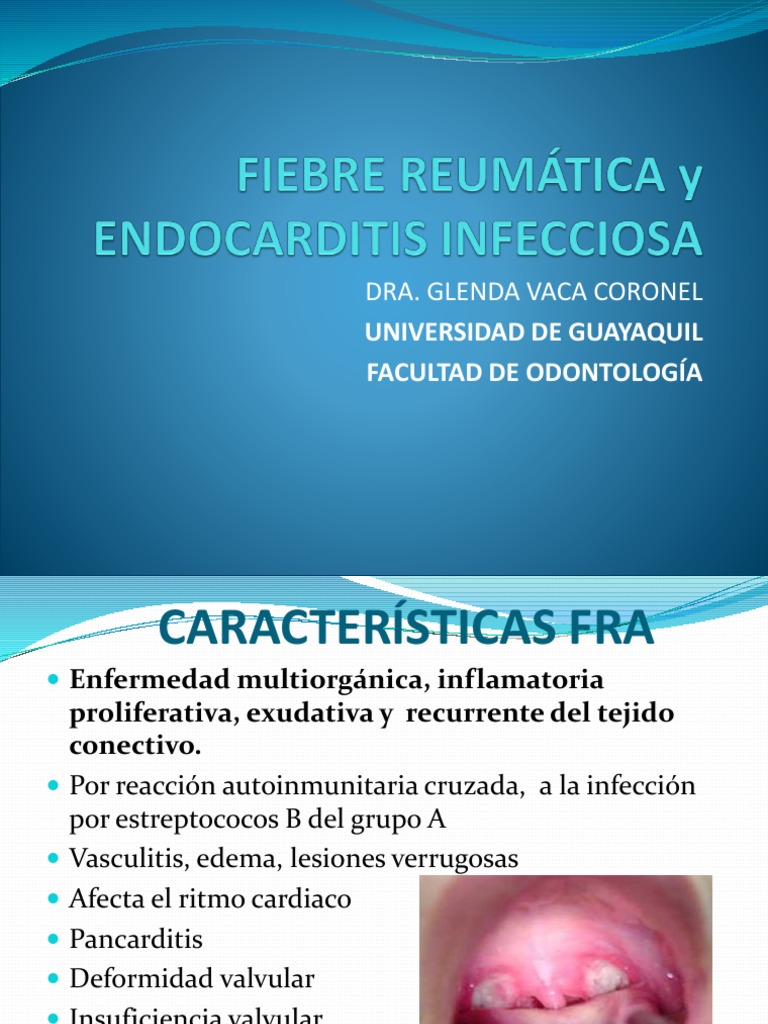 Fiebre Reumatica y Endocarditis | PDF | Corazón | Especialidades Medicas