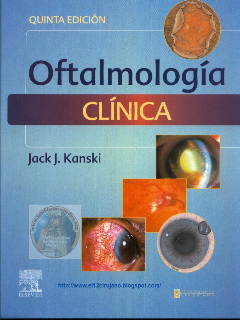 KANSKI Oftalmología PDF | PDF