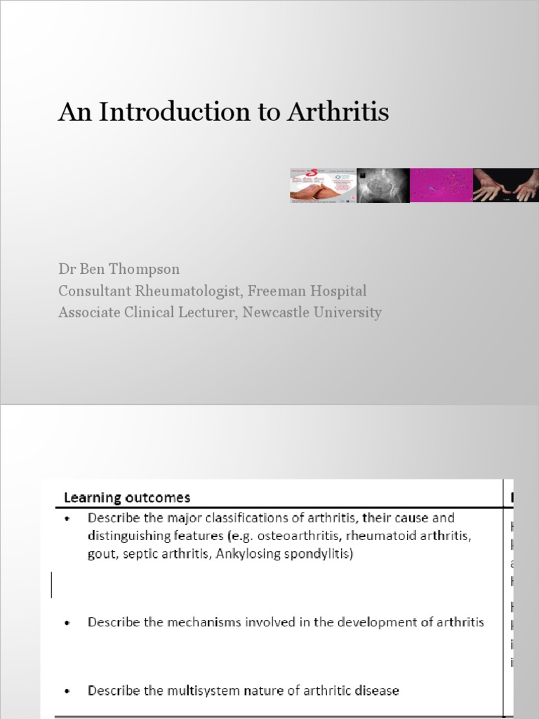 Introduction to Arthritis Overview | PDF | Arthritis | Rheumatoid Arthritis