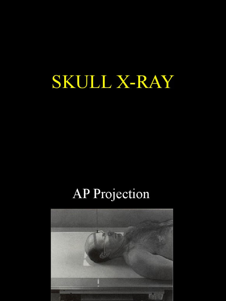 Head and Neck Radiology: Skull X-Ray | PDF | Skull | Human Head And Neck