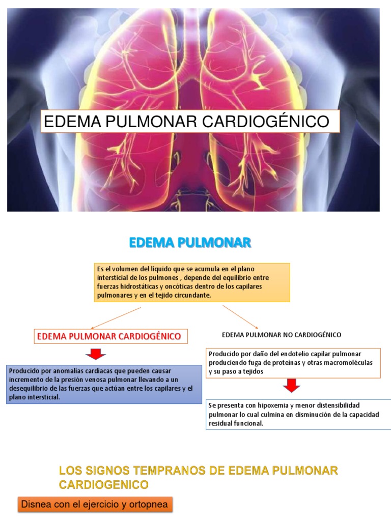 Edema Pulmonar Cardiogénico | Edema | Pulmón
