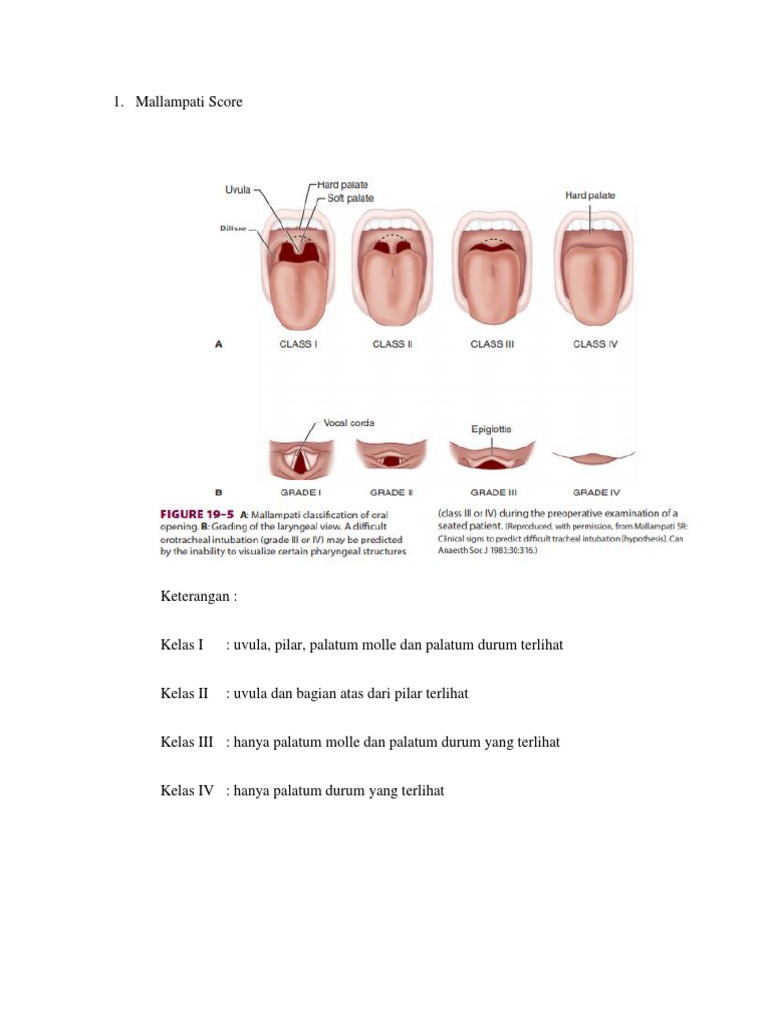 Mallampati Score | PDF