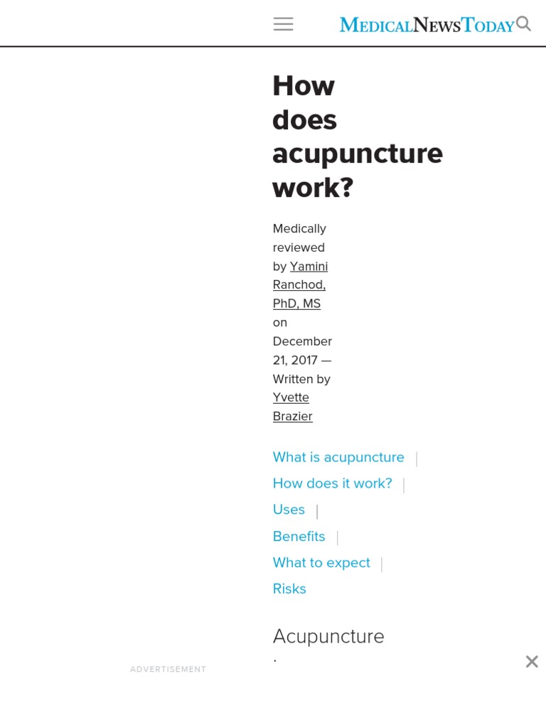 Acupuncture: How It Works, Uses, Benefits, and Risks | PDF ...