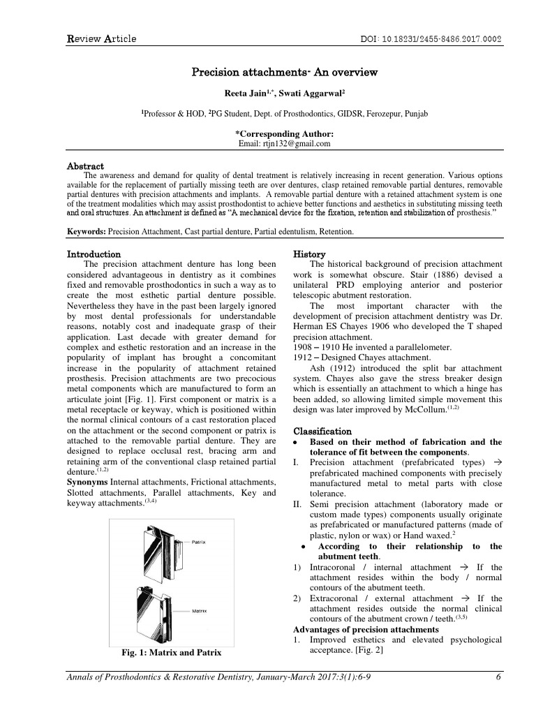 Precision Attachments in Removable Partial Dentures: An Overview of ...