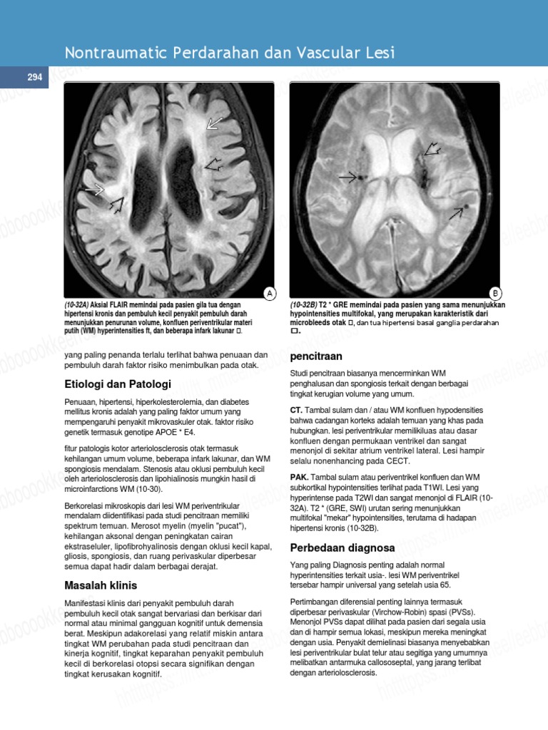 Osborn. Brain (PDF - Io) (3) - Converted - En.id | PDF
