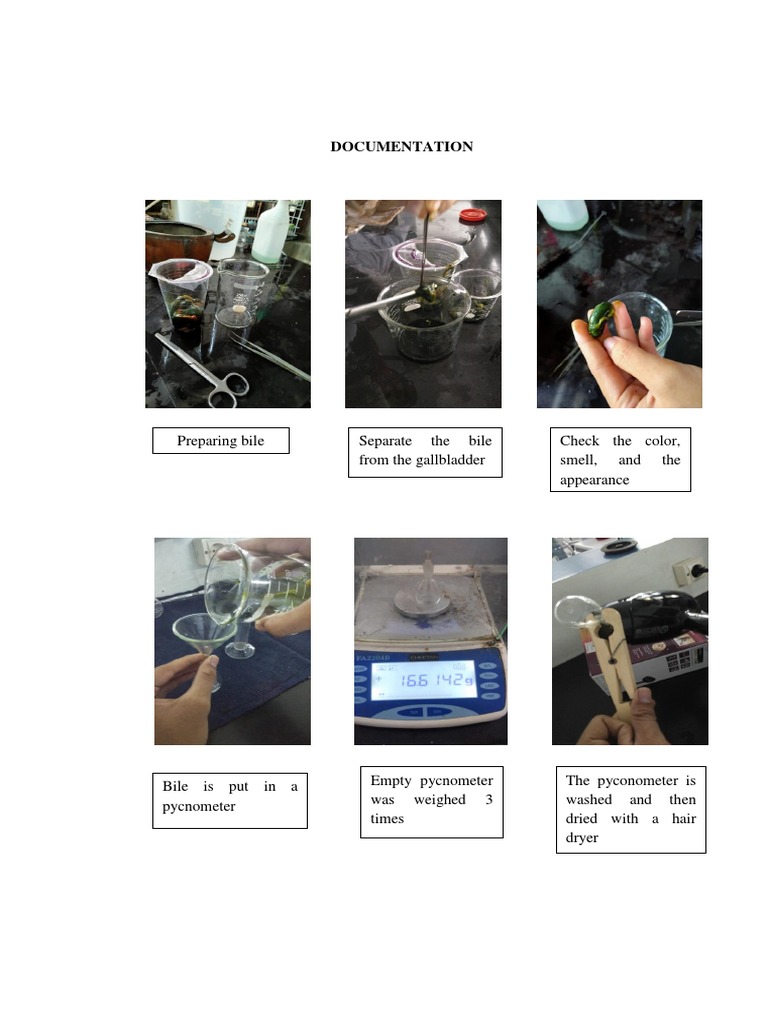 Documentation: Preparing Bile Separate The Bile From The Gallbladder ...