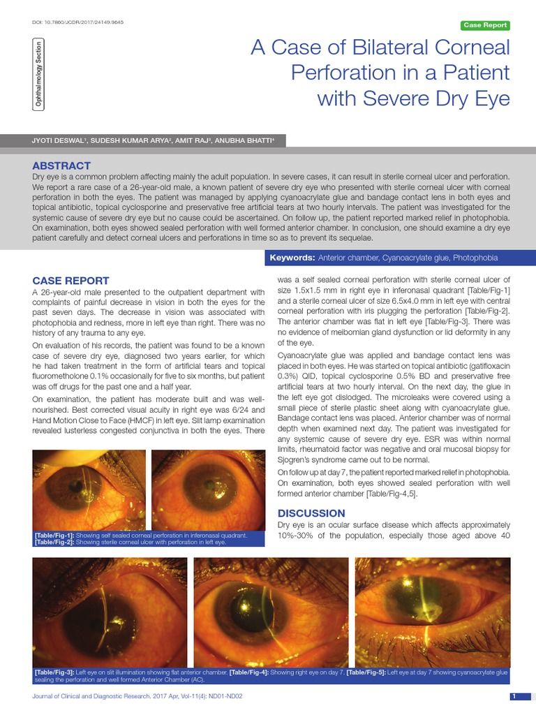 A Case of Bilateral Corneal Perforation in A Patient With Severe Dry ...