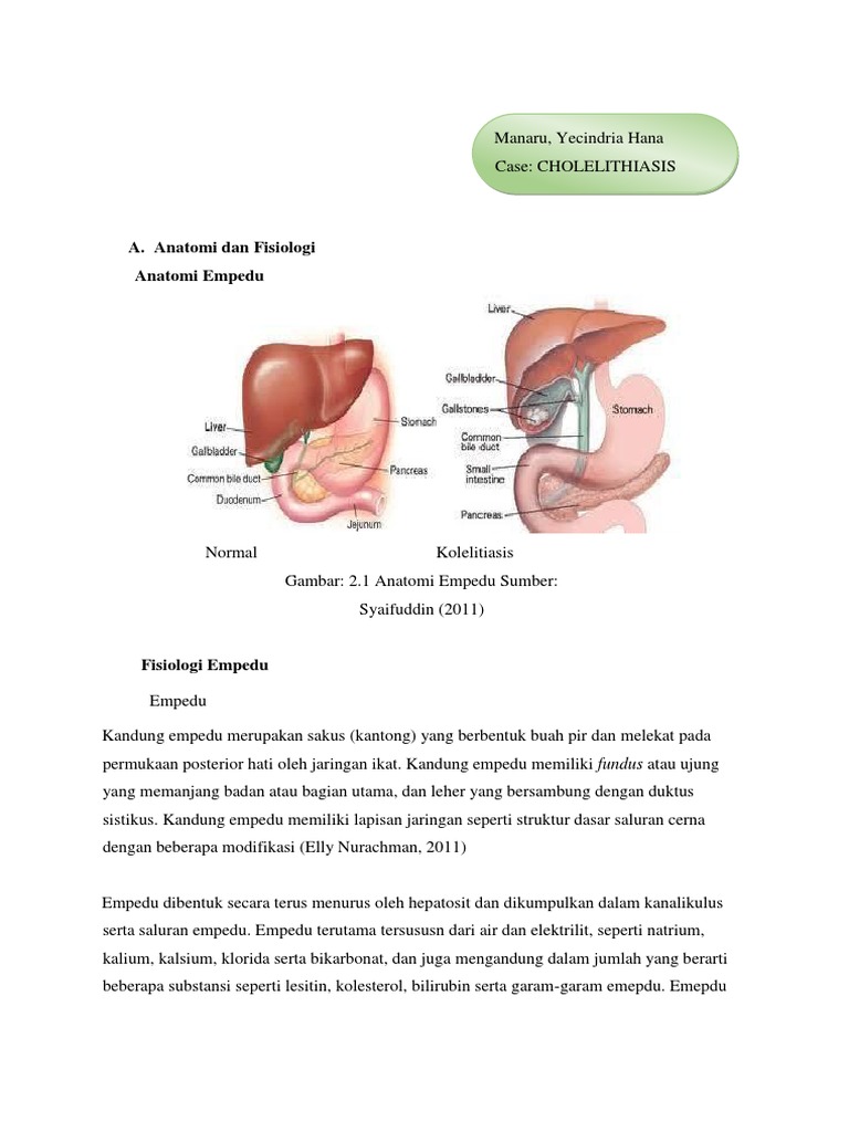 LP Cholelithiasis | PDF