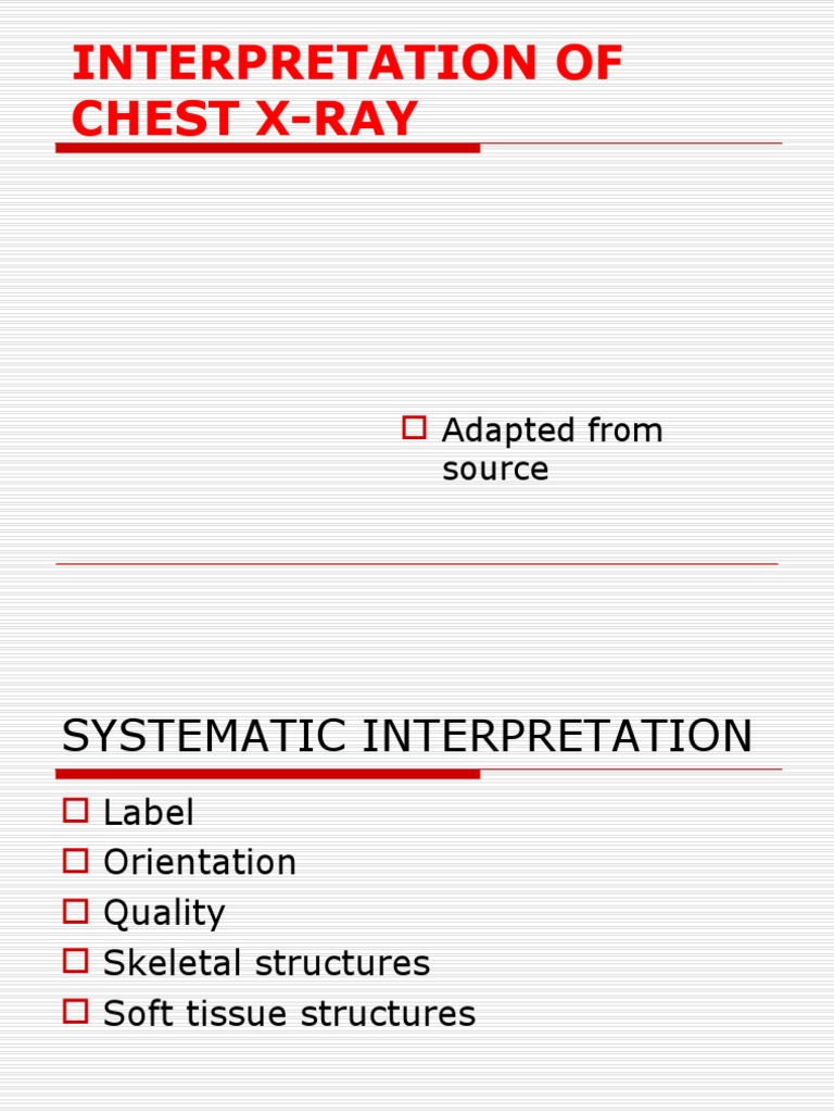 How To Read CXR Edited | PDF | Lung | Heart