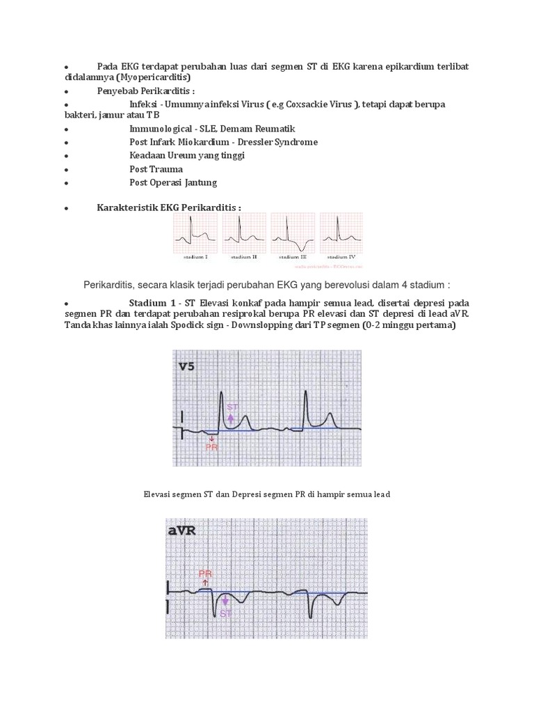 Ekg Perikarditis | PDF