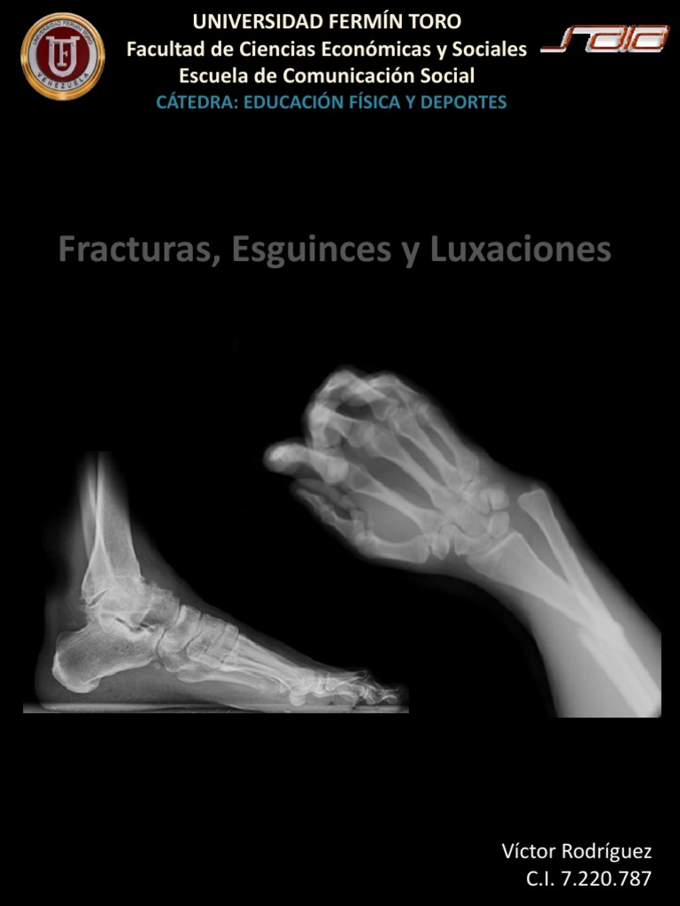 Fracturas y Luxaciones | PDF | Dolor | Edema
