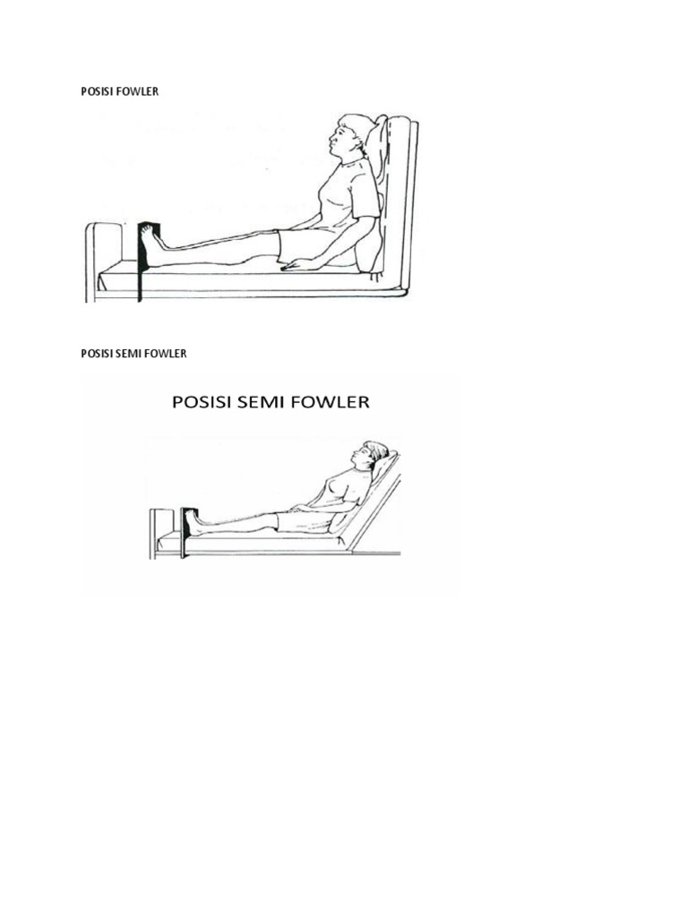 Posisi Fowler | PDF