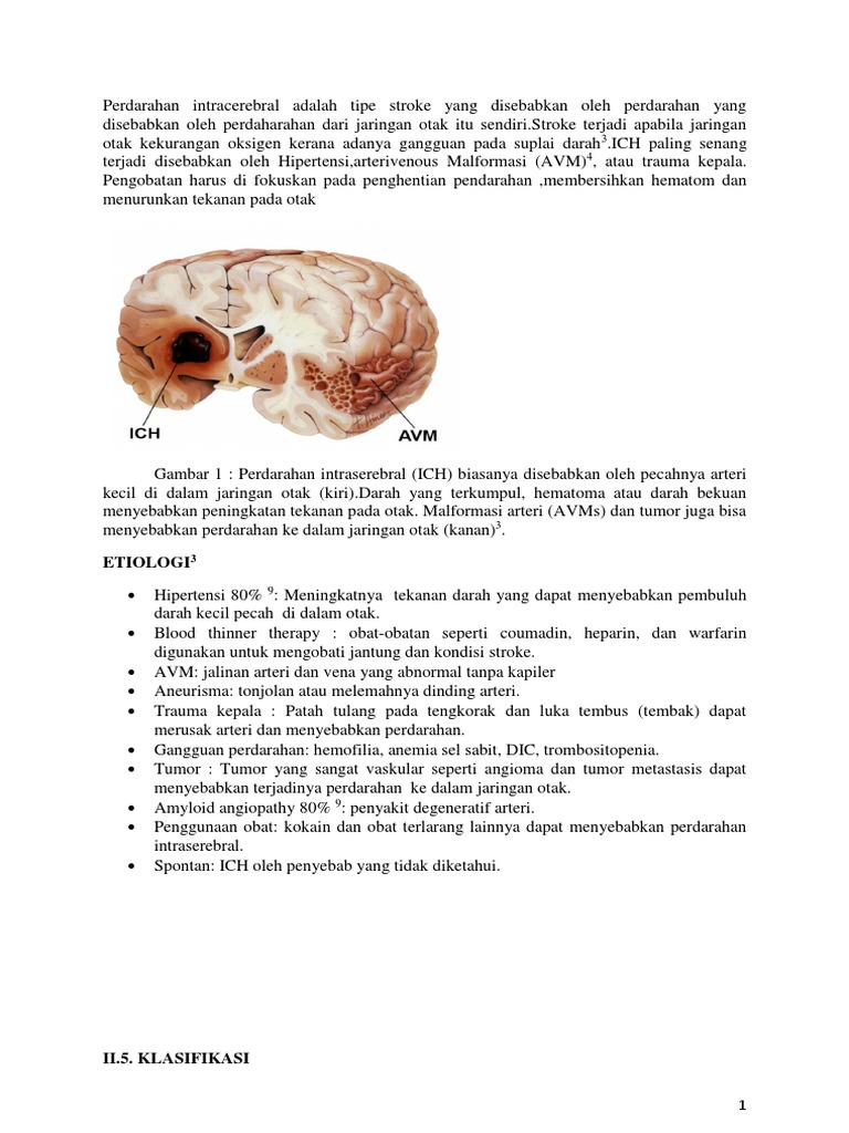 Perdarahan Intracerebral: Penyebab, Klasifikasi, dan Diagnosa | PDF ...