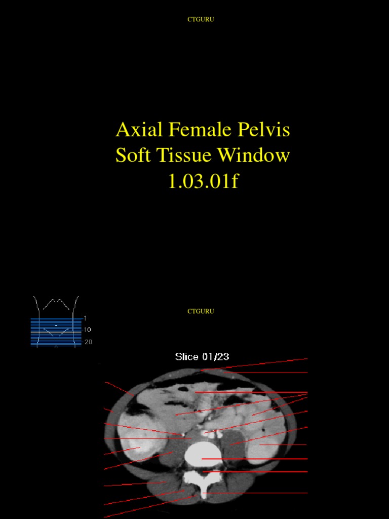 Axial Female Pelvis Soft Tissue 301f | PDF