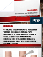 Procedimiento de Postioplastia | PDF