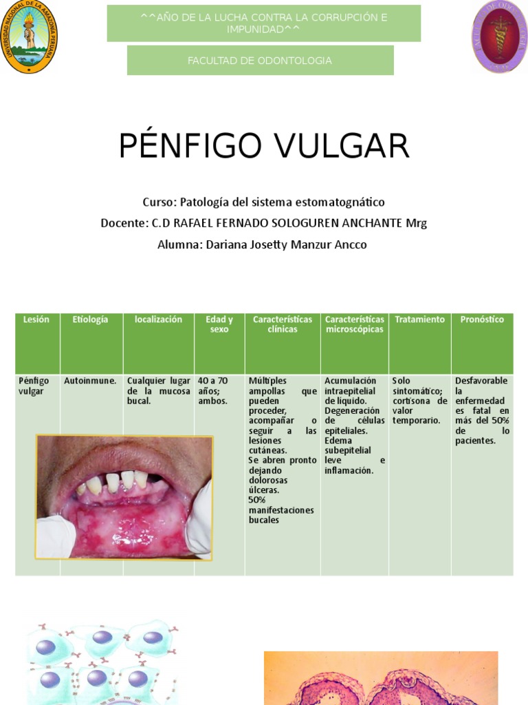 Penfigo Vulgar | PDF | Especialidades Medicas | Enfermedades y trastornos
