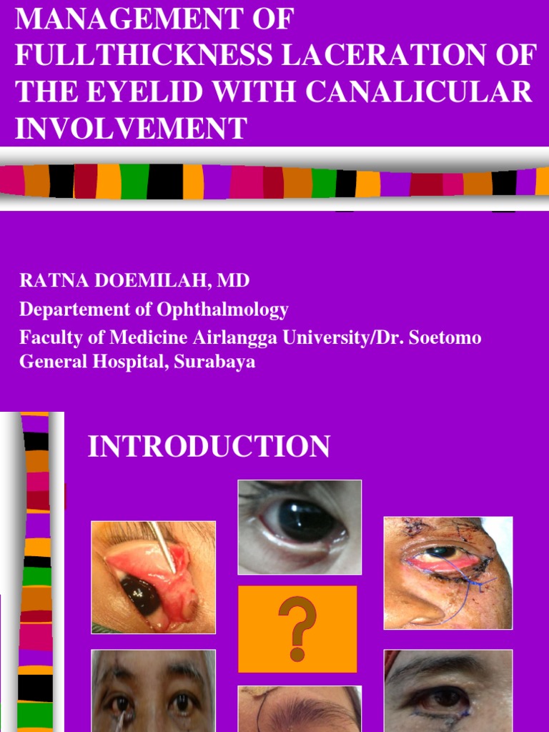 Repair of Full Thickness Eyelid Lacerations With Canalicular ...