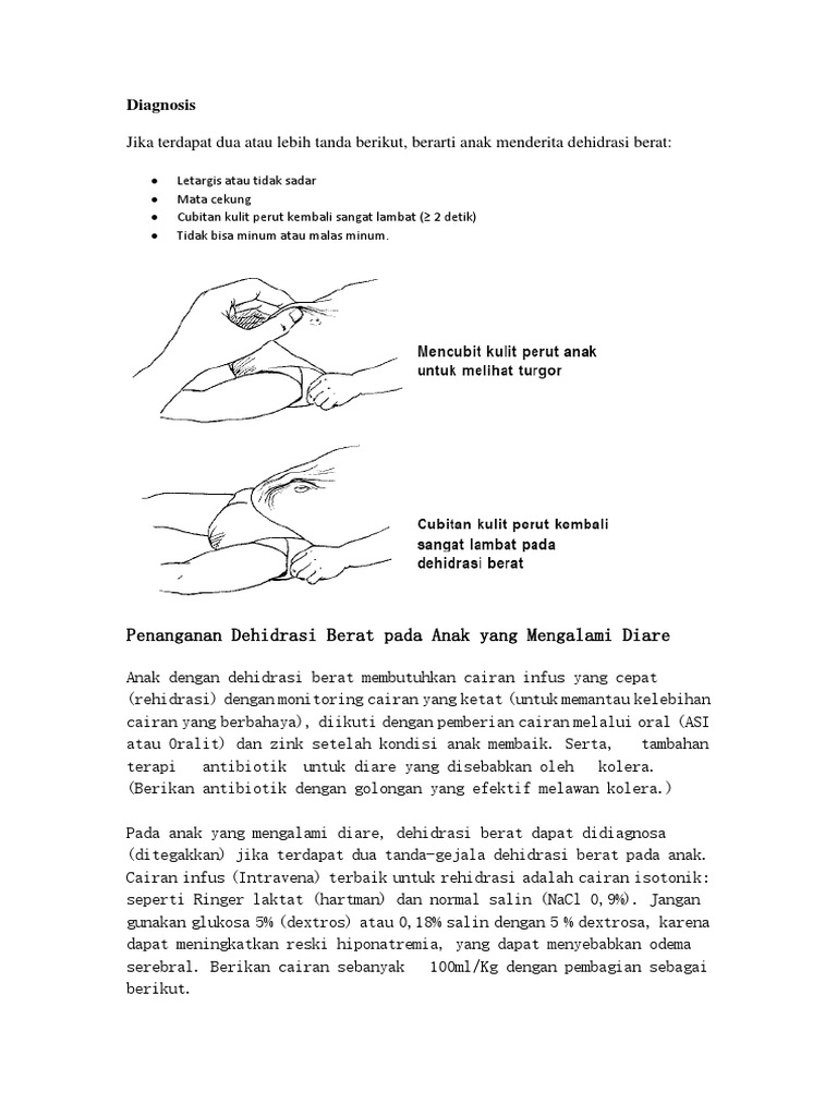 Penanganan Dehidrasi Berat Anak | PDF
