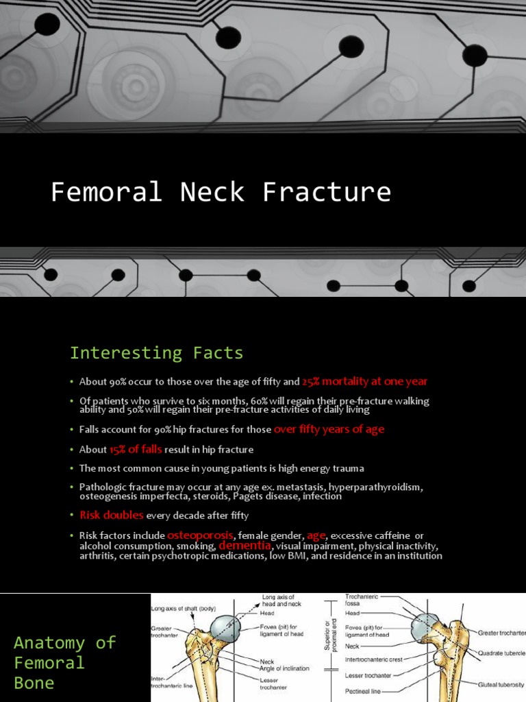 Femoral Neck Fracture | PDF | Hip | Human Leg