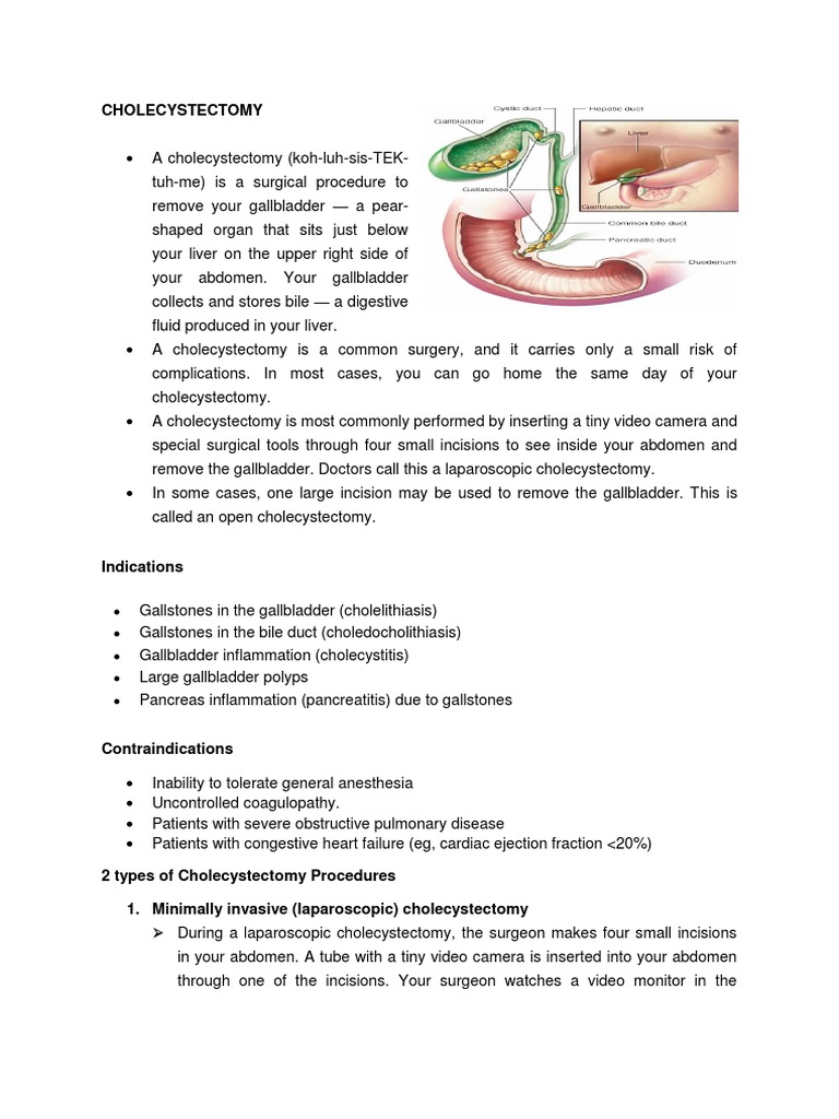 Cholecystectomy | PDF | Gallbladder | Organ (Anatomy)