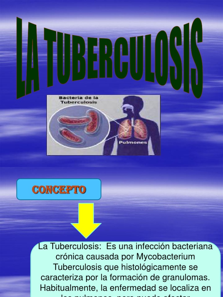 TUBERCULOSIS TRABAJO COMPLETO.ppt | Tuberculosis | Salud pública
