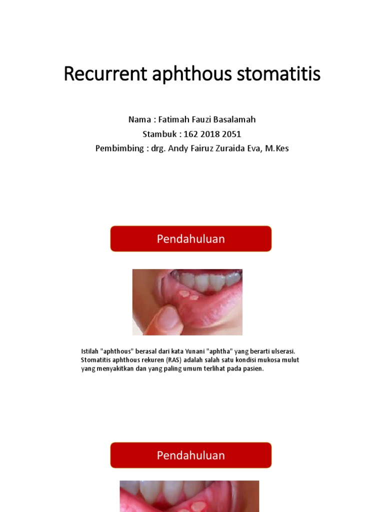 Recurrent Aphthous Stomatitis | PDF