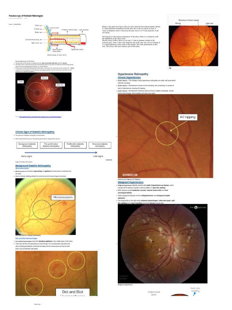 Funduscopy of Retinal Pathologies | PDF | Retina | Glaucoma